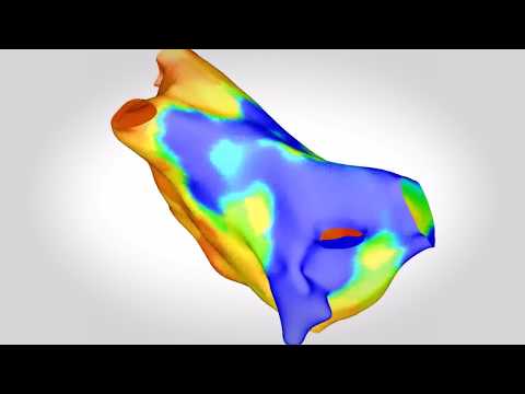 How imaging is transforming care for cardiac patients