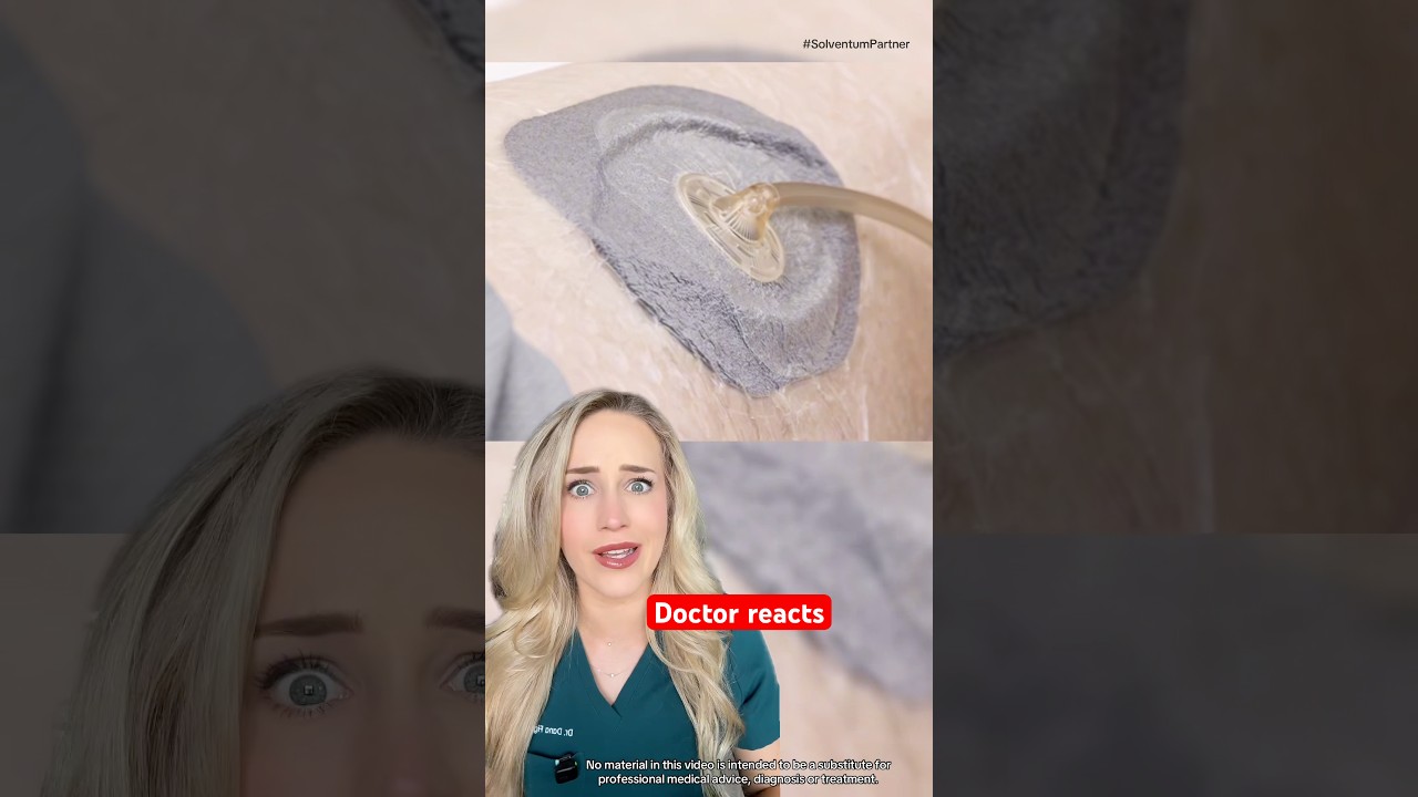 #sponsored Curious how negative pressure wound therapy, aka V.A.C.® Therapy actually works?