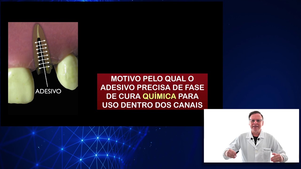 Superfiber Splint – Superdont