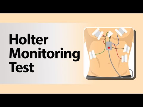 Holter Monitoring Test