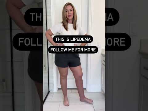 Lipedema Awareness
