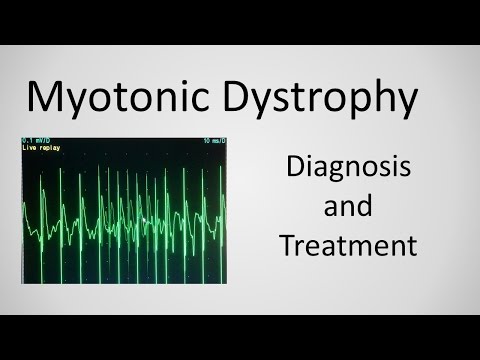Myotonic Dystrophy Diagnosis and Treatment explained
