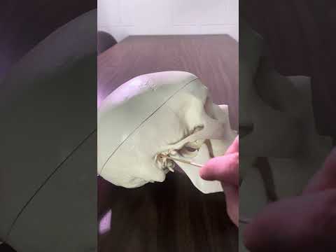 Temporal Bone of the Skull