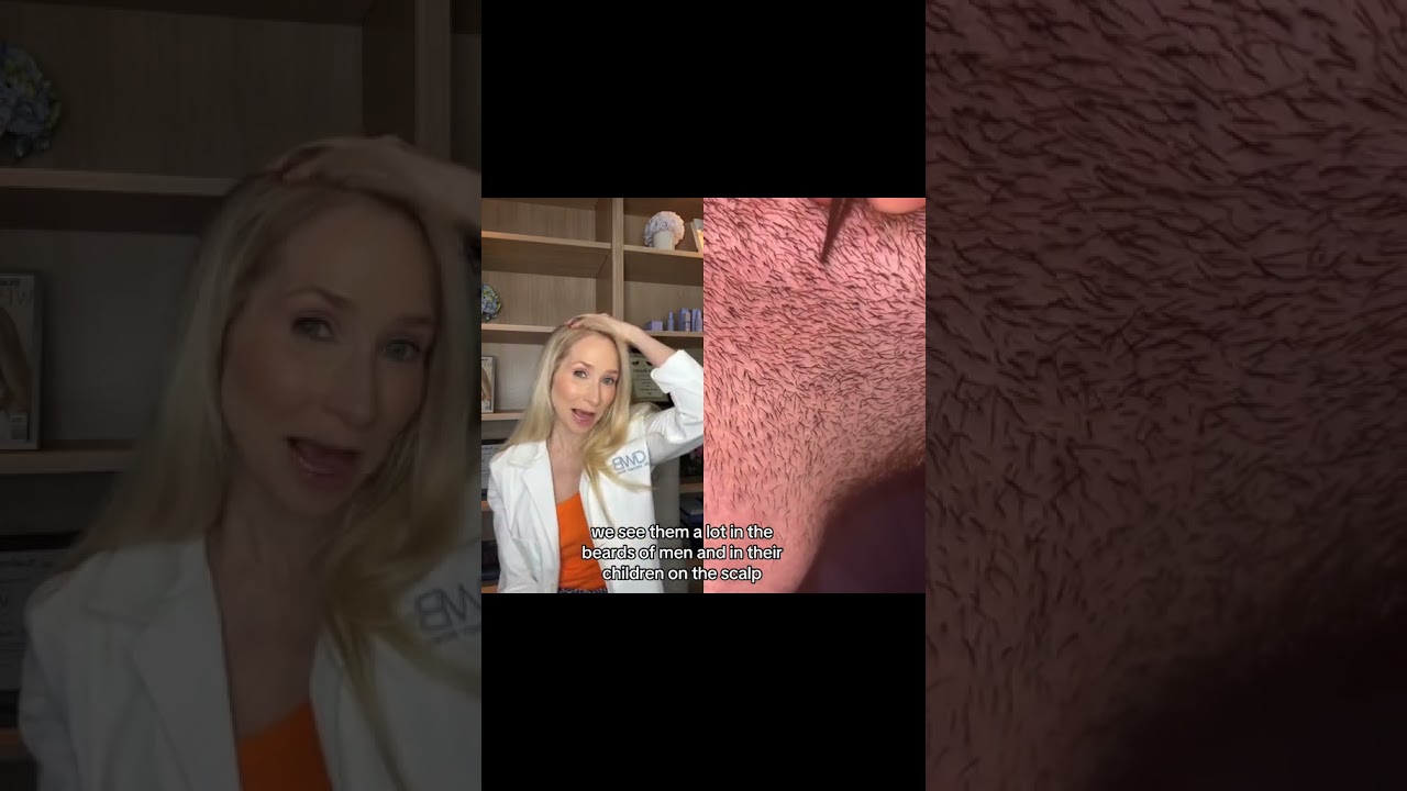 Dermatologist Reacts to Hair Plucking #shorts