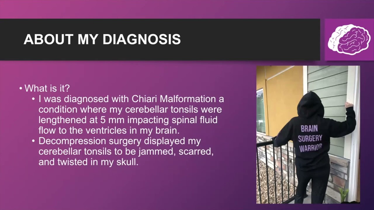 Learn about Hannah Jane (Chiari Malformation)