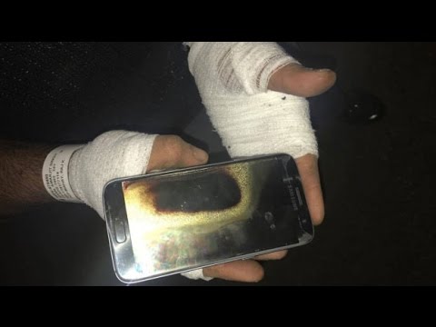 Samsung Galaxy S7 Explodes in Man's Hands, Causes Him Second-Degree ...
