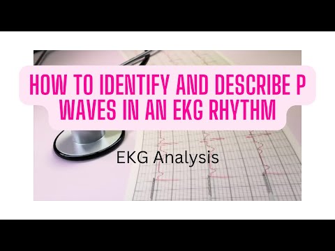 Identifying and describing P waves in an EKG rhythm