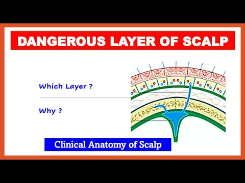 DANGEROUS LAYER OF SCALP – Anatomy QA
