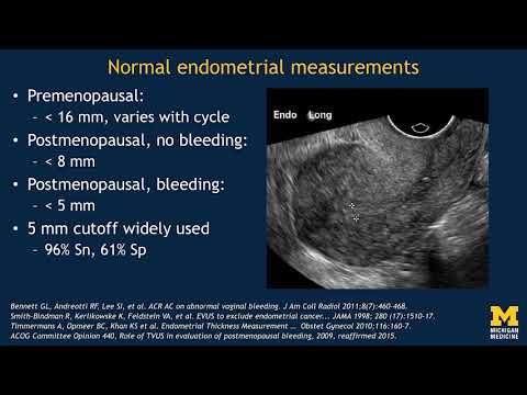 uterine malignancy