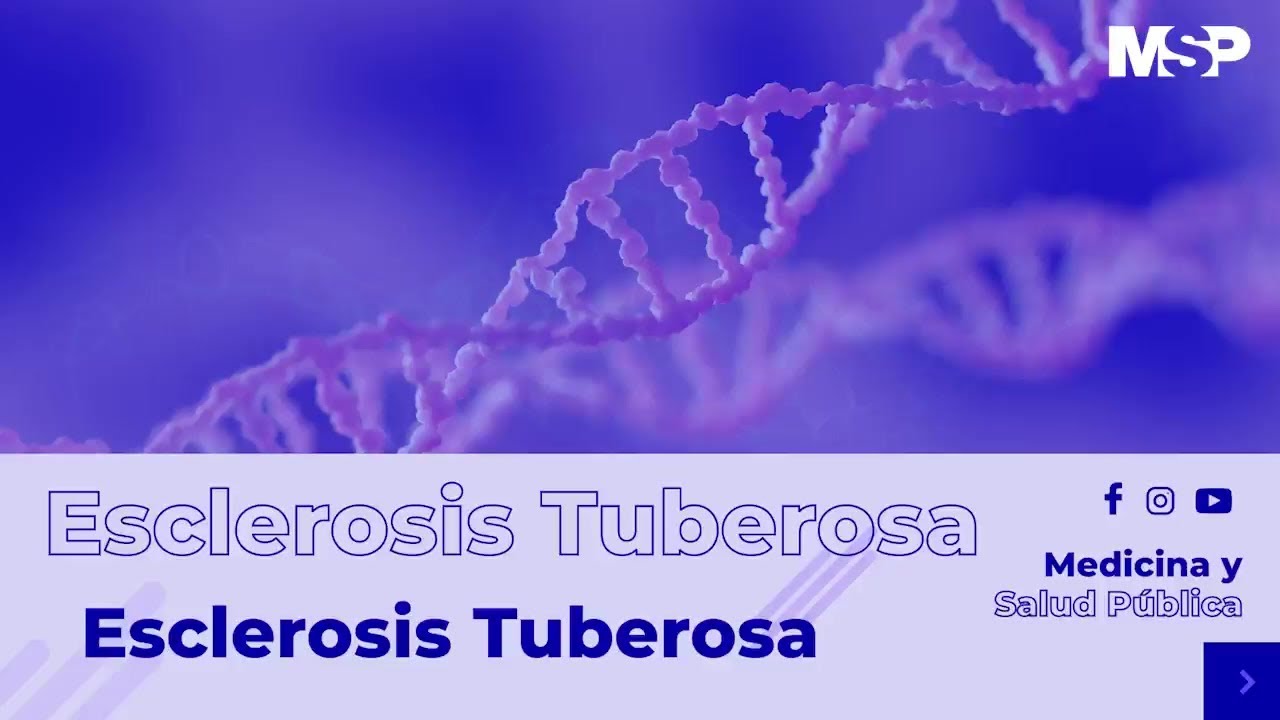 Tuberous sclerosis