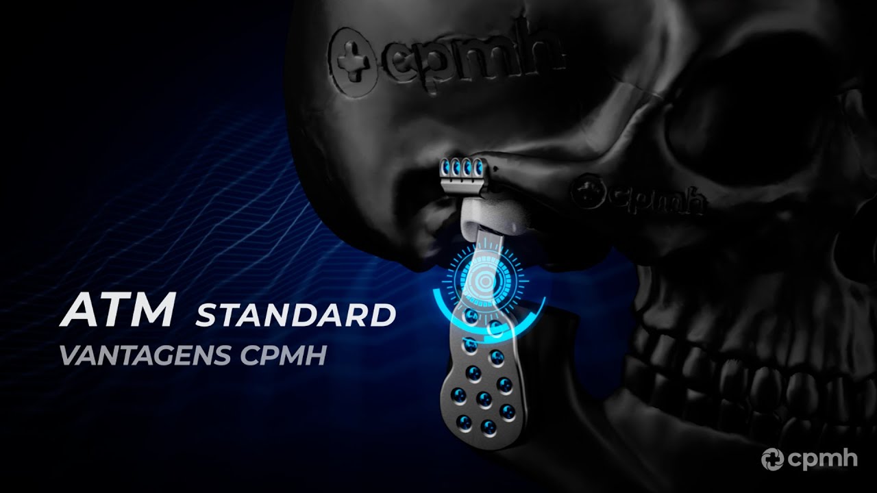 Home | CPMH Digital - Soluções cirúrgicas - impressão 3D