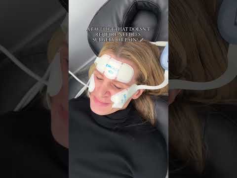Have Your Heard of EMface: the painless, non-invasive facelift?🤔