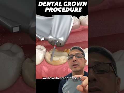 How to Prepare for a Dental Crown (SIMPLY EXPLAINED) | In Office to Hands On Dental Training #shorts