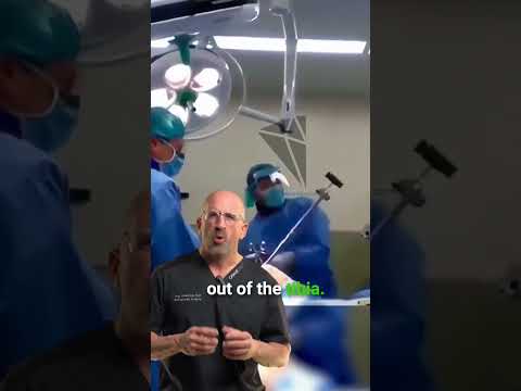 More Hammer🔨Tibial Nail Surgery #shorts