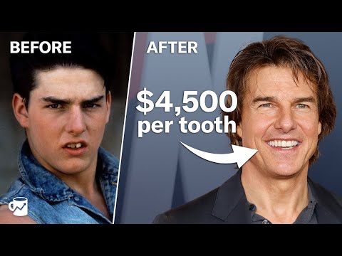 Why everyone has fake teeth now