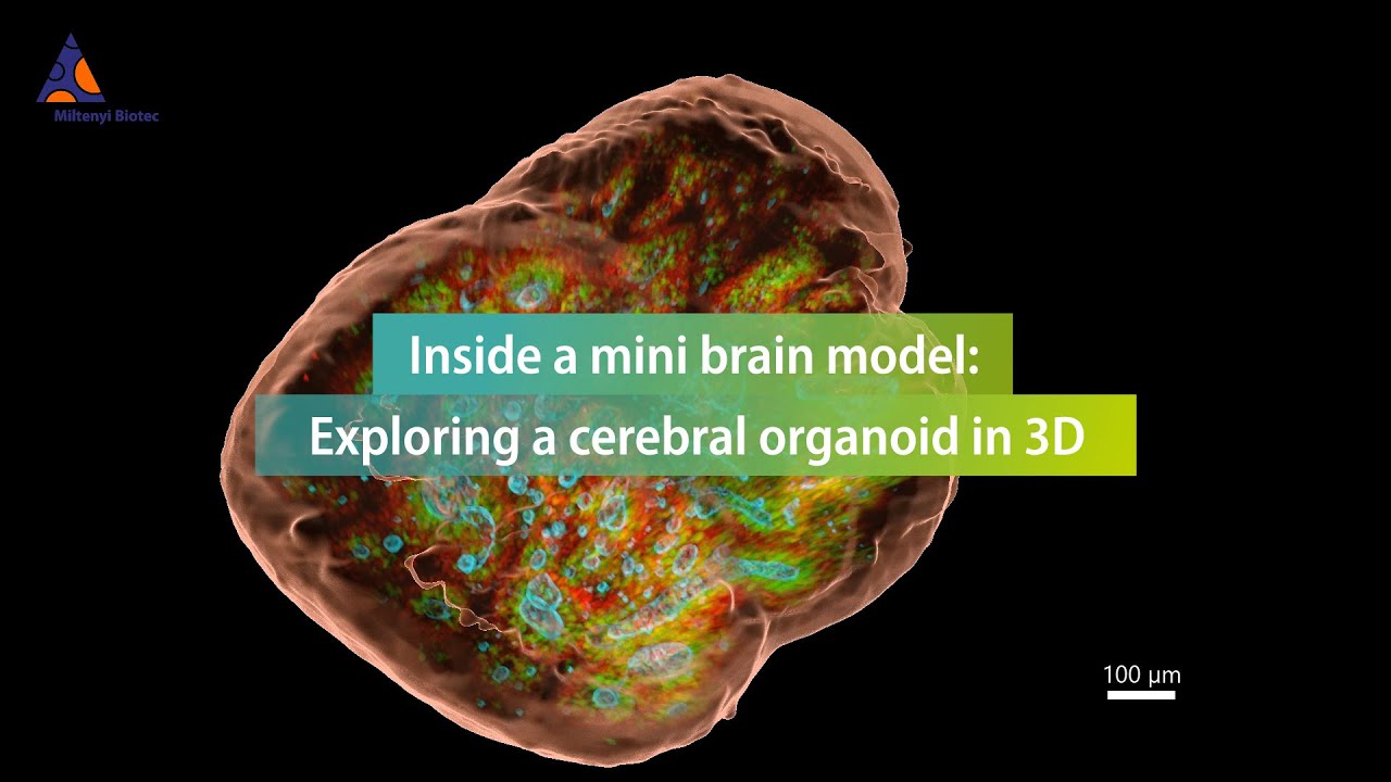 Inside a mini brain model: Exploring a cerebral organoid in 3D