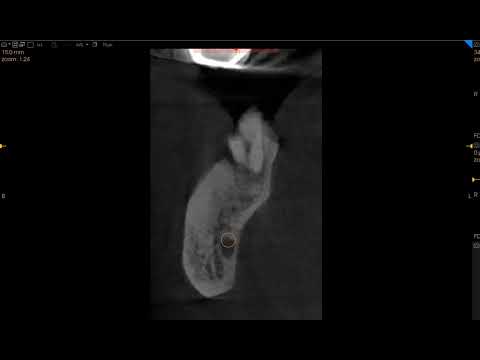 FM - Dr. F