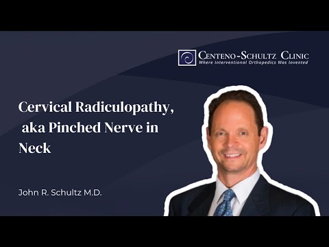 Cervical Radiculopathy, aka Pinched Nerve in Neck: Symptoms, Causes, & Treatment
