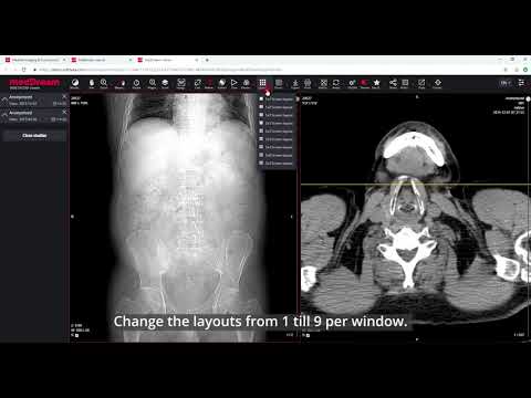 MedDream DICOM Viewer: the layouts
