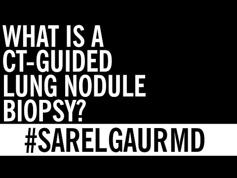 What is a CT-Guided Lung Nodule Biopsy?