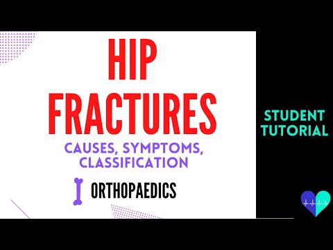 Hip Fractures (causes, symptoms & classification) - Medical Tutorial