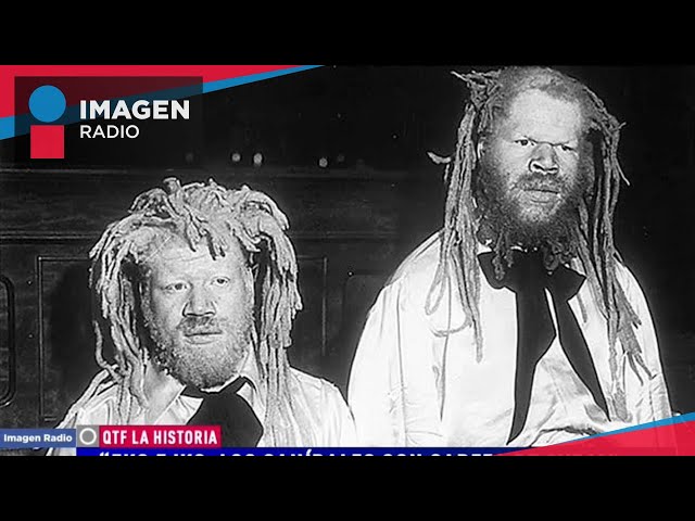 Eko e Iko, los hermanos que fueron obligados a actuar en un circo ...