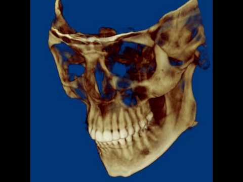 3D Imaging i-CAT