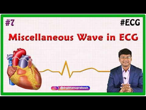 7. Miscellaneous Wave in ECG - ECG assessment and ECG interpretation made easy