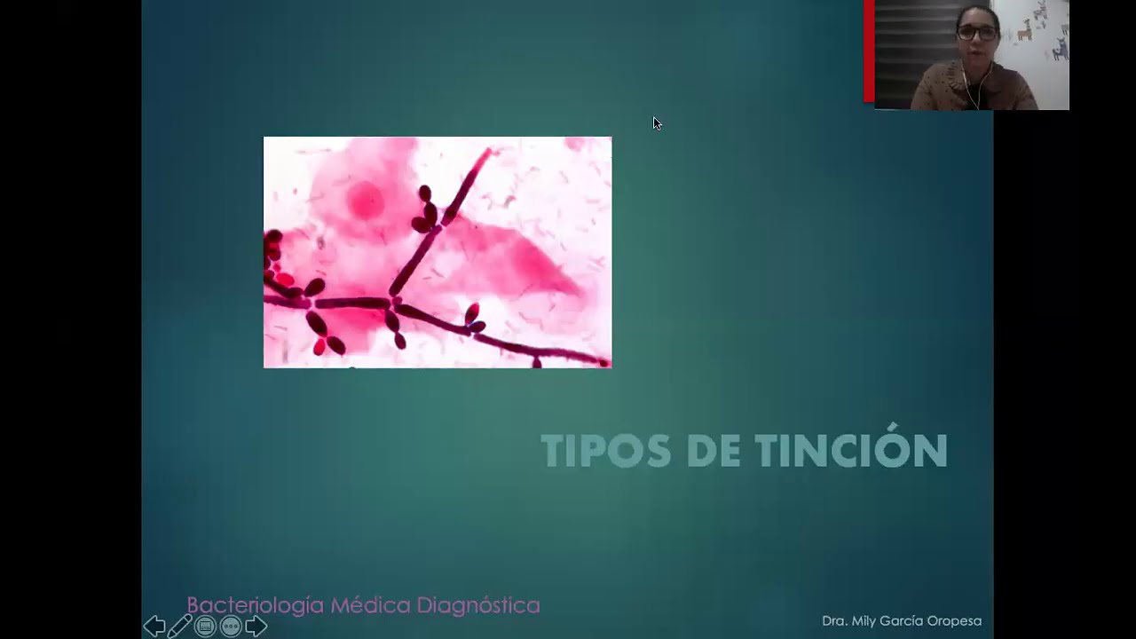 TIPOS DE TINCIÓN