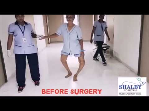 Witness the Power of Shalby’s "Zero Technique” Total Knee Replacement Surgery
