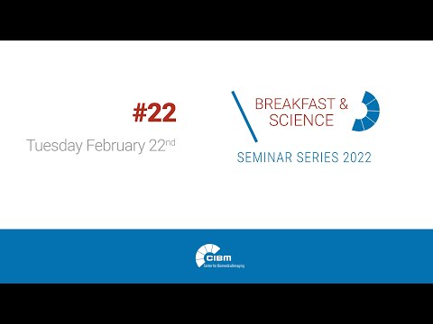 CIBM Breakfast & Science 22 with Prof Patrik Vuilleumier