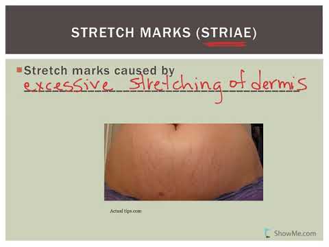 Integumentary System Part II - Dermis, Hypodermis, and Accessory Structures