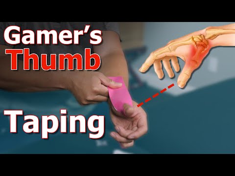One SIMPLE Taping Method To Relieve Gamer's Thumb | Taught By A Physical Therapist