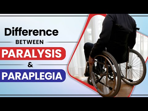 Difference Between Paralysis & Paraplegia | What is the Main Cause of Paraplegia | SRIAAS