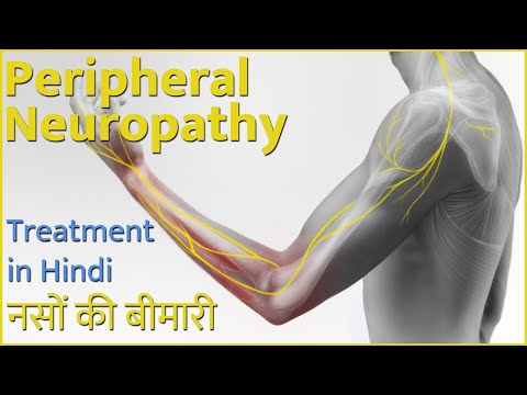 PERIPHERAL NEUROPATHIC PAIN IN HINDI- what is peripheral neuropathy? what can be done about it?