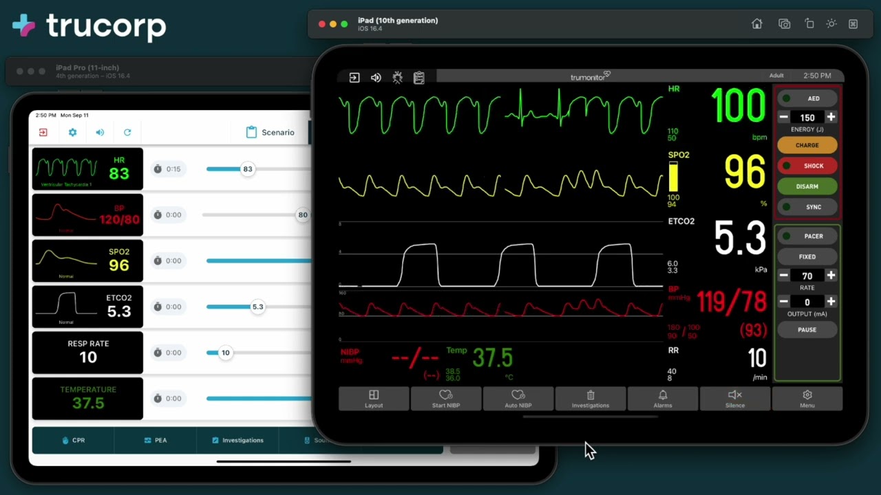 TruMonitor Quick Start - Basic Controls