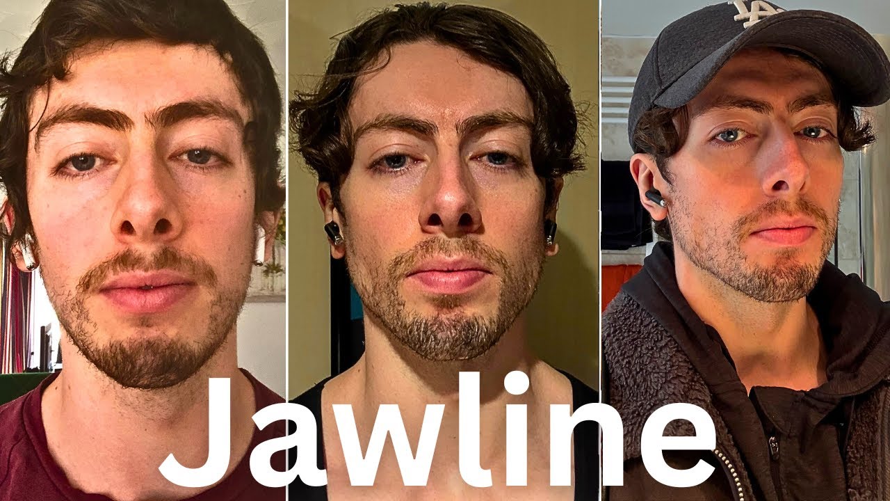 Mewing Transformation - 4 Year Results