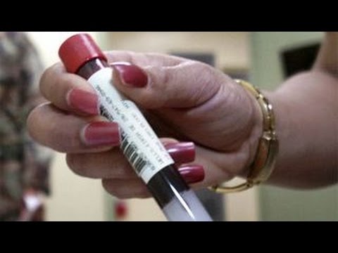 Blood test reveals every virus you ever had?