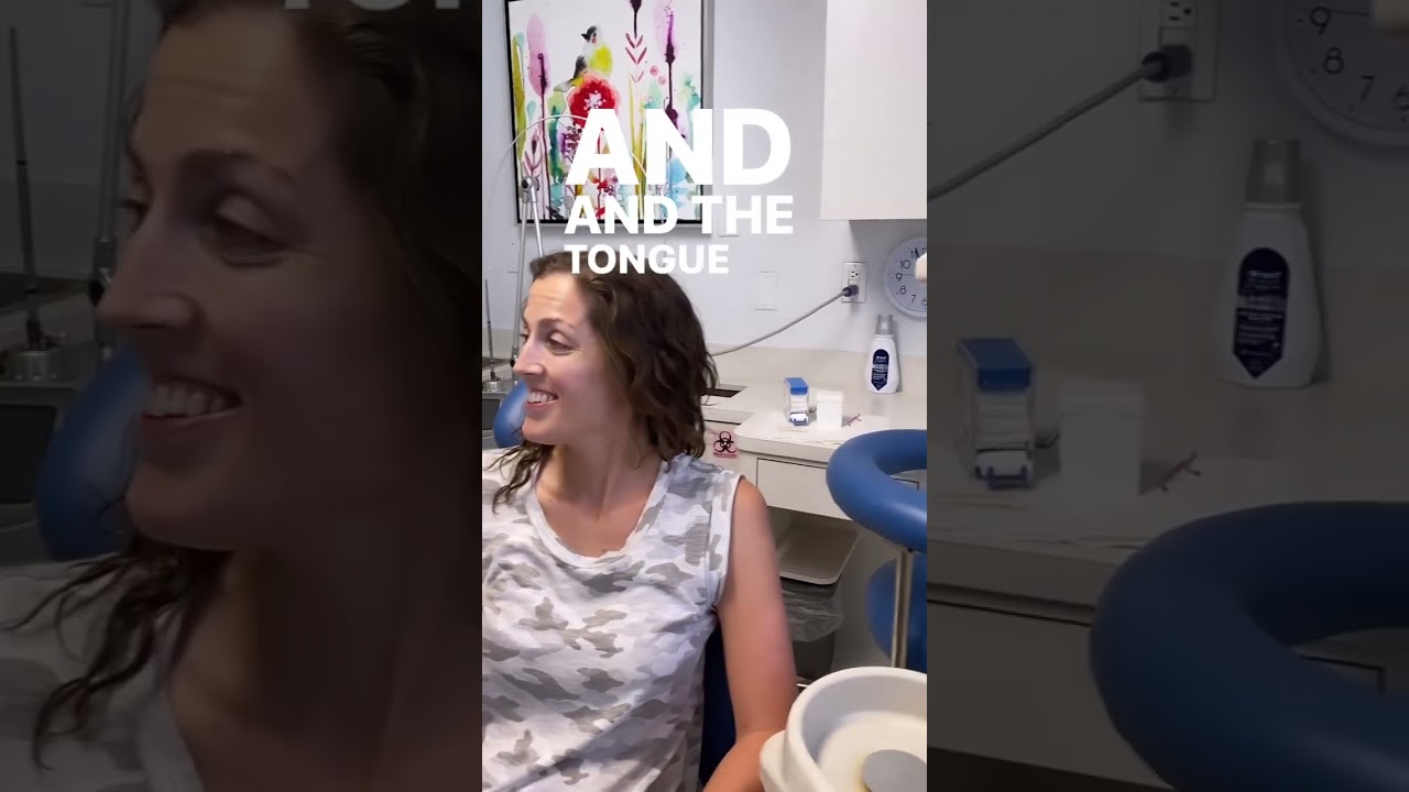 Minutes after a frenectomy procedure #Shorts