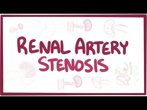 Renal artery stenosis - causes, symptoms, diagnosis, treatment, pathology