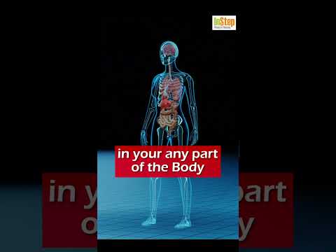 Relieve Pain and Improve Mobility with Dry Needling ~ In Step Physical Therapy Edmonton