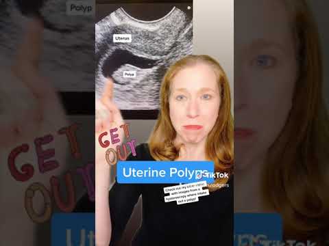 Uterine Polyps