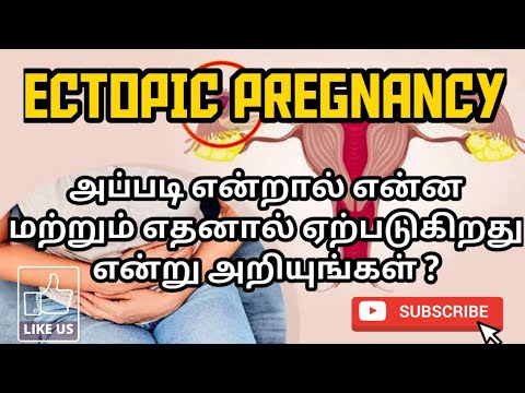ECTOPIC PREGNANCY | CAUSES | DIAGNOSIS | TREATMENT | PREVENTION | PHARMA TAMIL | RK | #135