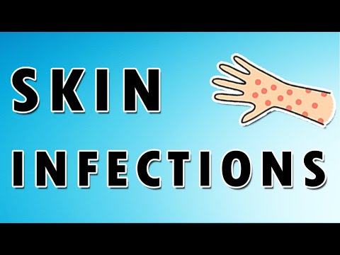 Common Skin Infections