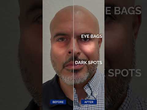 Imagine If Women Had It This Easy, With Particle Face Cream | Particle For Men Shorts