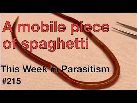 TWiP 215: A mobile piece of spaghetti