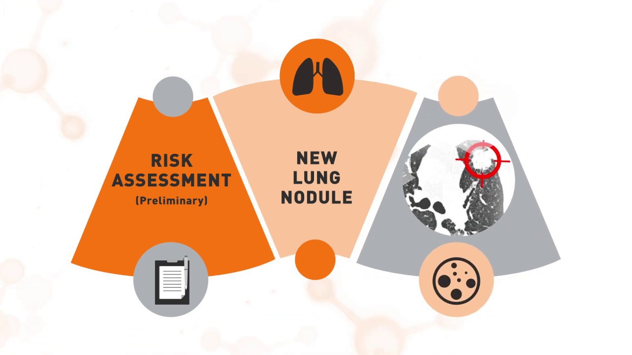 How does Nodify Lung™ testing work?