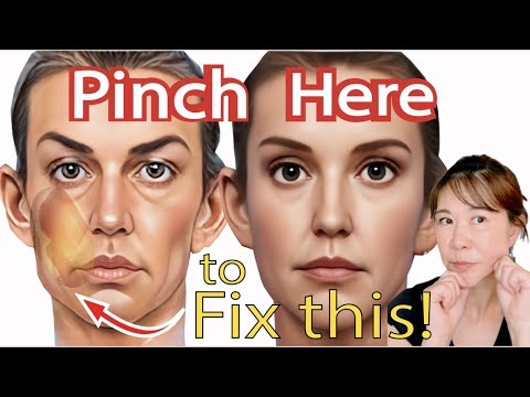 Pinch to Boost Collagen Everyday for 10 min and Look 10 Years Younger!!