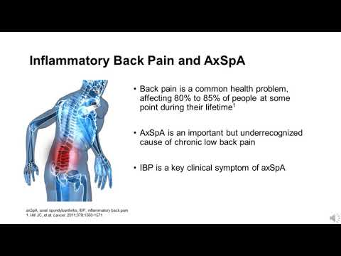 MCP 60 Seconds With Dr Marina Magrey on Axial-Spondyloyarthritis