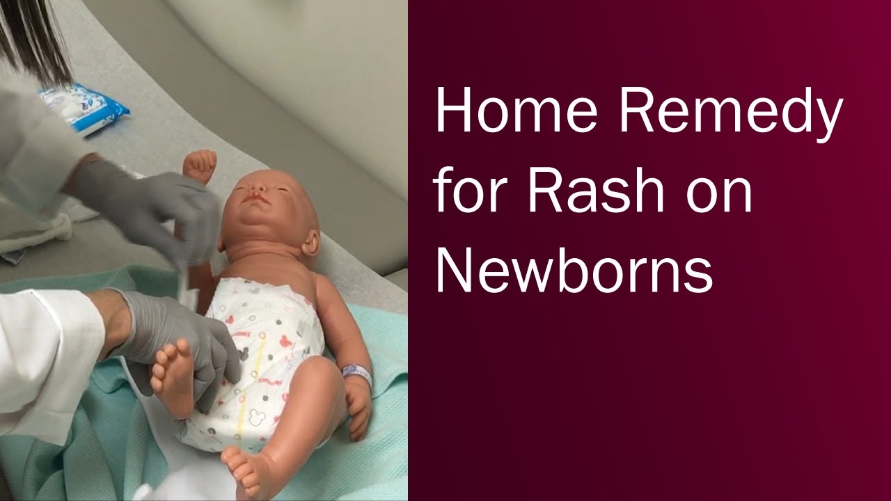 How to treat a diaper rash